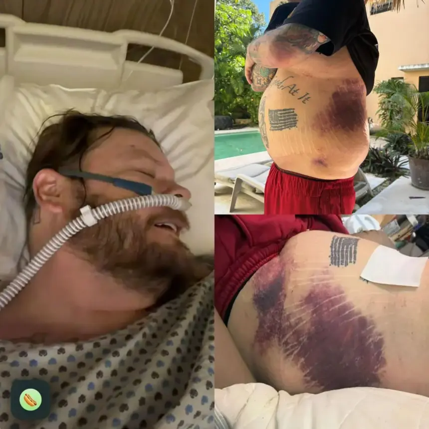 Corey Harrison solicita ayuda tras accidente de moto en Tulum